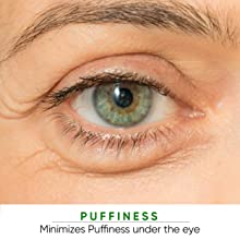 How to Care for Under Eye Skin: Natural Remedies for Dark Circles ...